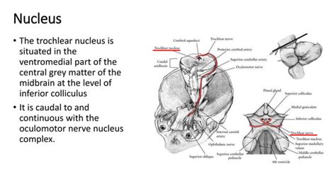 Anatomy Of Trochlear Nerve Ophthalmology Pptx