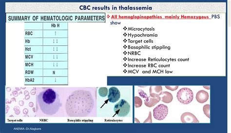 Alfa Thalassemia Syndromes Pdf