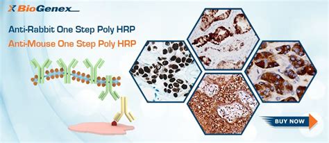 Biogenex On Linkedin Detectionsystem Detectionkits Ihc