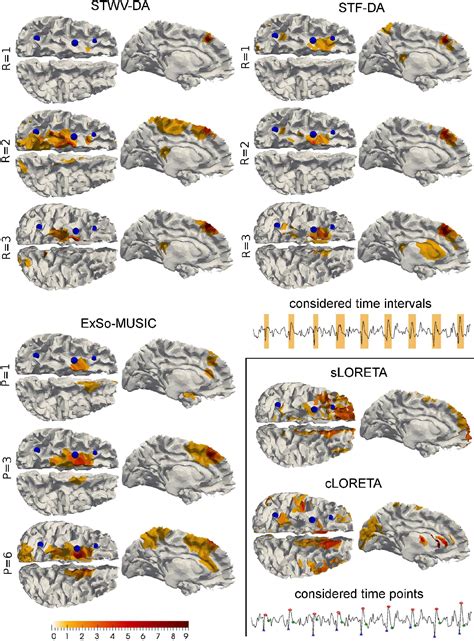 Figure 1 From Eeg Extended Source Localization Tensor Based Vs