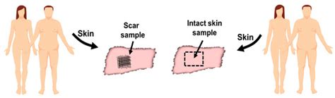 Gender Differences In Post Operative Human Skin