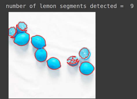 Image Segmentation And Object Counting By Eshaan Medium