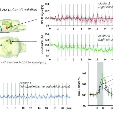 summary of bold activation pattern induced by stimulation of the
