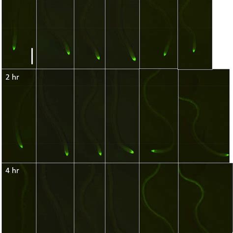 Fluorescence Stereomicrographs Displaying Gfp Expression Of Tcsn Gfp Download Scientific