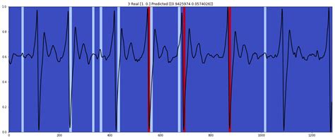How Ai Based Arrhythmia Detector Can Explain Its Decisions By Artem Bachynskyi Mawi Band