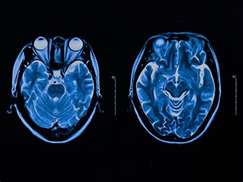 Googles Deepmind Has Key Breakthrough