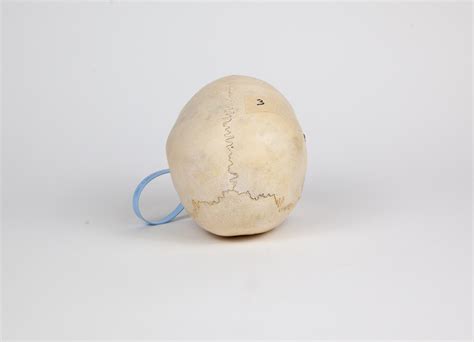 Pediatric Skull 0240 Jonsbones Responsibly Sourced Human Osteology