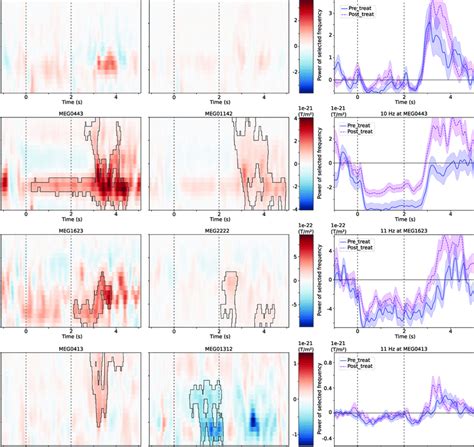 Modulation Of Sensorimotor Oscillations In Response To Contralateral Download Scientific