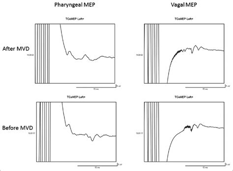Surgical Neurology International