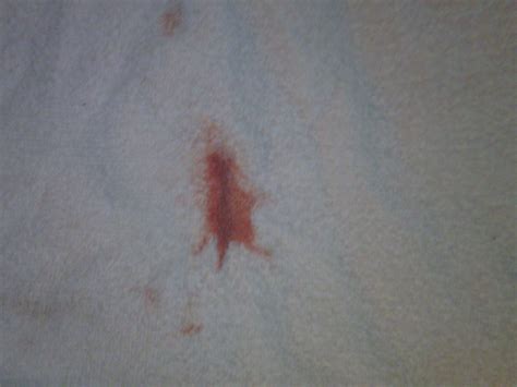 Period Tmi With Pic Please Help Glow Community