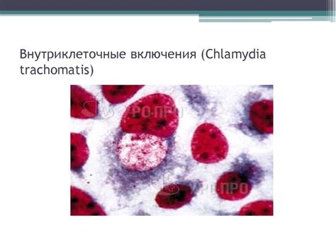 Хламидиозы. Классификация хламидий - online presentation