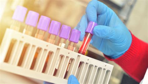 Detecting HIV Could One Day Be As Easy As Picking Up The Phone IFLScience