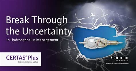 Michael Hohmann Posted On Linkedin