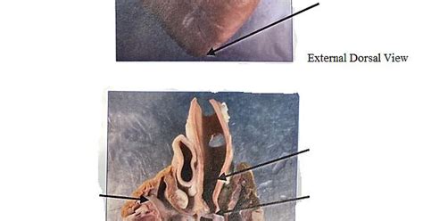 Unlablled Real Heart All Angles Album On Imgur