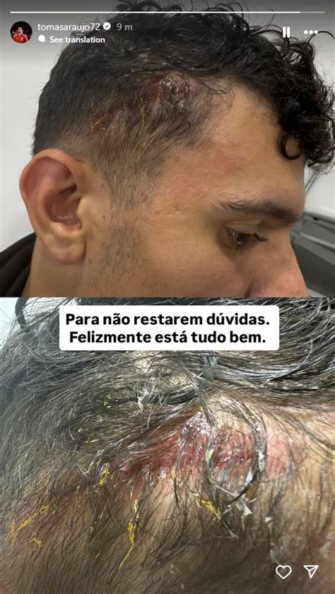 Tomás Aráujo Justifica Expulsão Do Santa Clara Para Que Não Restem