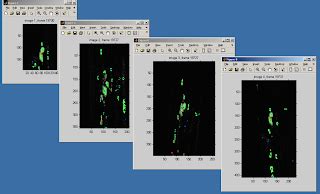 Image Processing Using Matlab EE Engineer