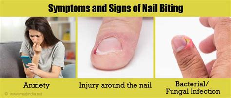 Symptoms And Signs Of Nail Biting