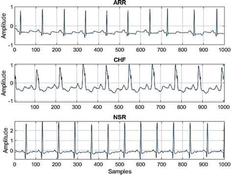 Figure 2 From Classifying Electrocardiograph Waveforms Using Trained