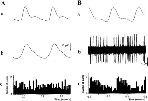 Cardiac Rhythmicity In Postganglionic Sympathetic Neuron Psn Download Scientific Diagram