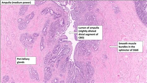 Ampulla Normal Histology Nus Pathweb Nus Pathweb