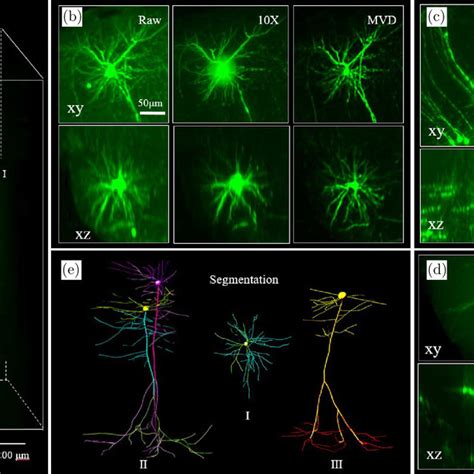 Isotropic Visualization Of Brain Cortex By Multi View Lsfm A The 3d Download Scientific