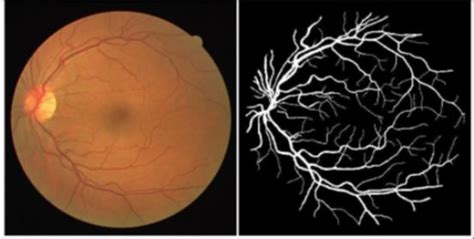 Muhammad Kashif On Linkedin Imageprocessing Matlab Medicalimageanalysis Github