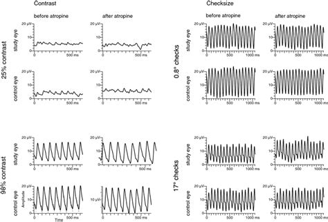 Representative Sample Traces Of One Participant Curves Represent The