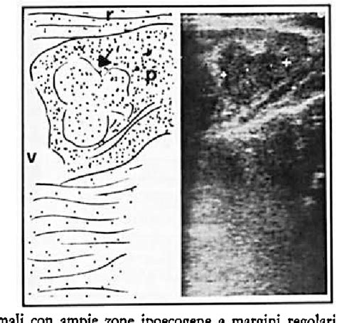 Stress Cardiac Echo Study Report Find Pt Heart Doc US Semantic Scholar