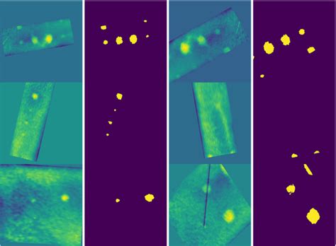 Transformed Images And Masks For Data Augmentation Download