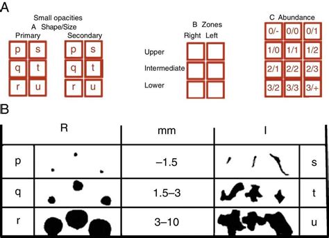 Ilo Classification Wikipedia
