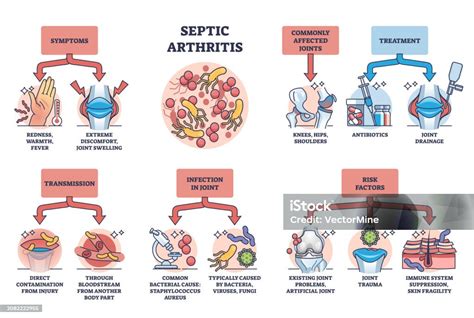 Septic Arthritis As Joint Infection And Infection In Bone Outline