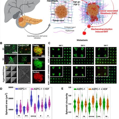 Schematic Of Pancreatic Cancer Development And Cancer Spheroid Download Scientific Diagram