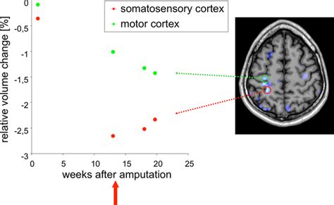 Brain Morphometry Citizendium