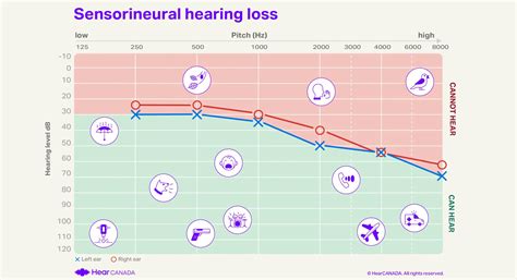 How To Read An Audiogram Essential Types And Symbols