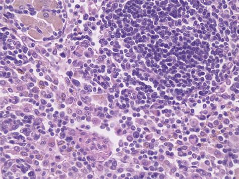 Lymph Node Human Slide Prepared Slides