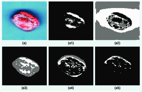 Impact Of Exponential Parameter P In Segmentation Results A Original