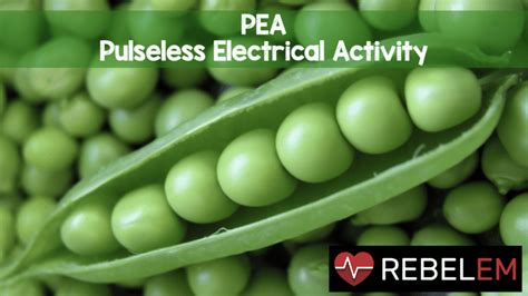 Beyond Acls A New Pulseless Electrical Activity Algorithm Rebel Em Emergency Medicine Blog