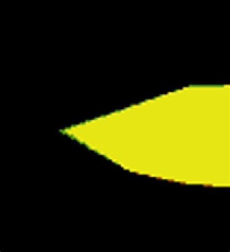 Illustration Of The Area Mismatch Face Asymmetry Metric Workflow A