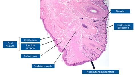 Practical Oral Cavity Histology Flashcards Quizlet