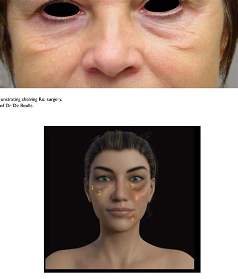 Differential Diagnosis Of Swelling Edema 2 Malar