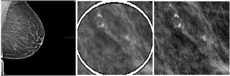 Sample Region Of Interest Roi Extraction From A 43 Year Old African Download Scientific