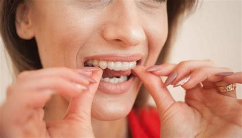 Byte Invisible Braces Byte Reviews