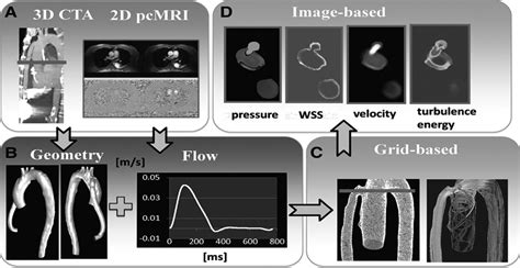 Influence Of Lvad Cannula Outflow Tract Location On Hemodyna Asaio
