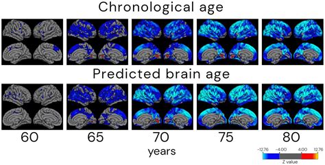 Frontiers A Deep Learning Model For Brain Age Prediction Using Minimally Preprocessed T1w
