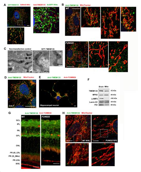Localization Of Tmem135 To The Mitochondria A Mitochondrial Download Scientific Diagram