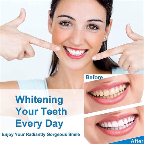 Body Accel Whitening Toothpaste With Niacinamide Stain Removal