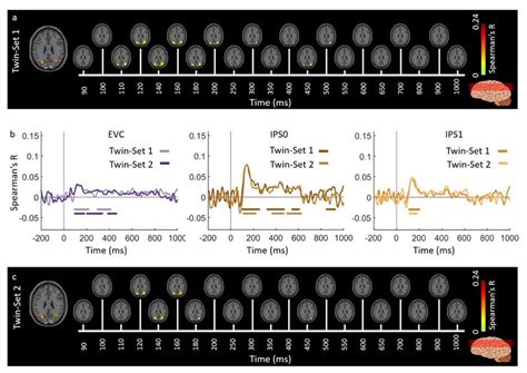 Experiment 1 Twins Set Spatiotemporal Neural Dynamics Of Vision In