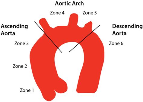 Ultrasound Examination Zones For The Thoracic Aorta The Ascending