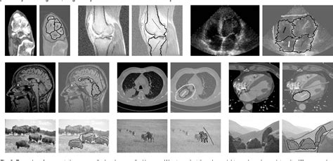 figure 8 from random walks for image segmentation semantic scholar