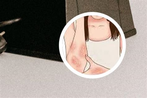 保定银屑病医院保定银屑病诊疗机构保定银屑病诊疗中心预约平台 中原银屑病网